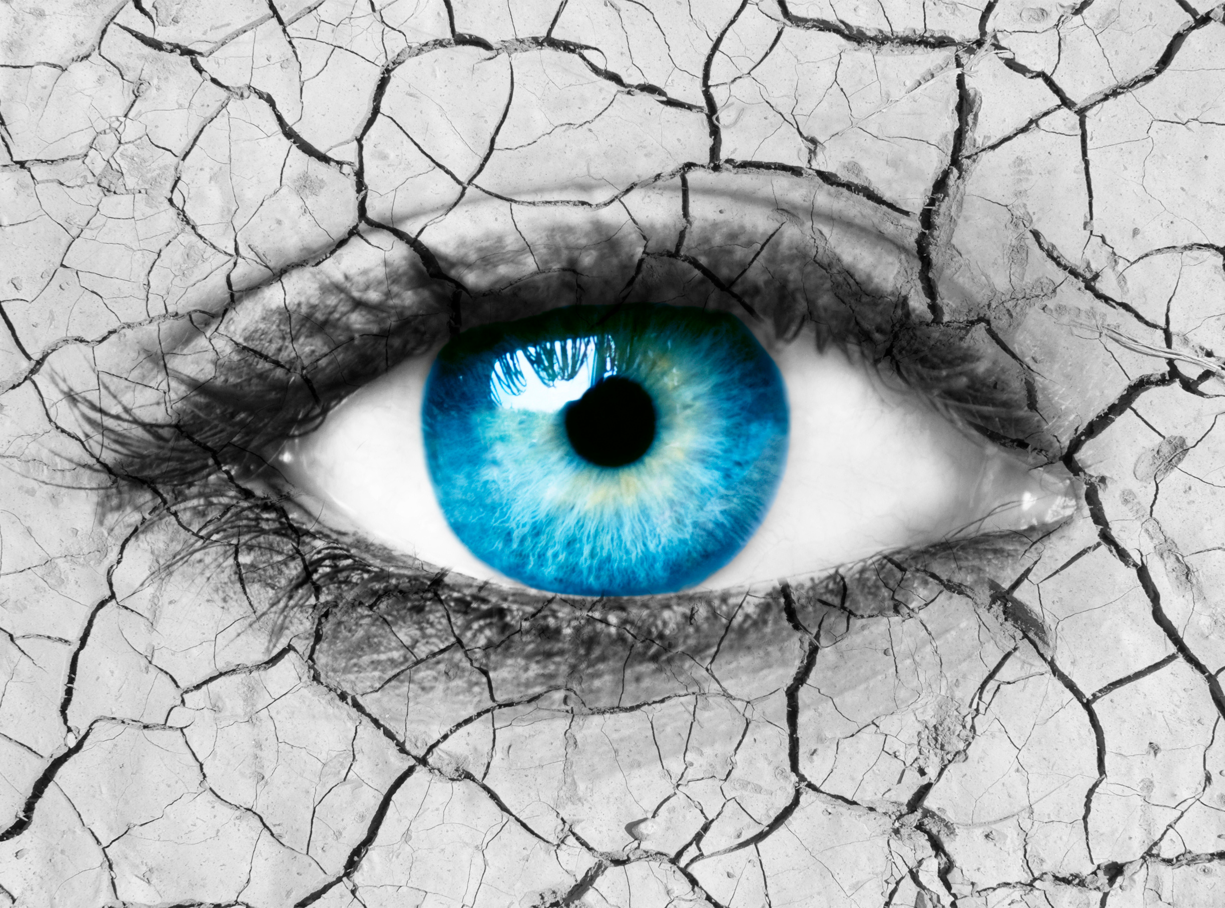 Dr. Michael Lange’s Dry Eye Protocol - Dr. Michael Lange